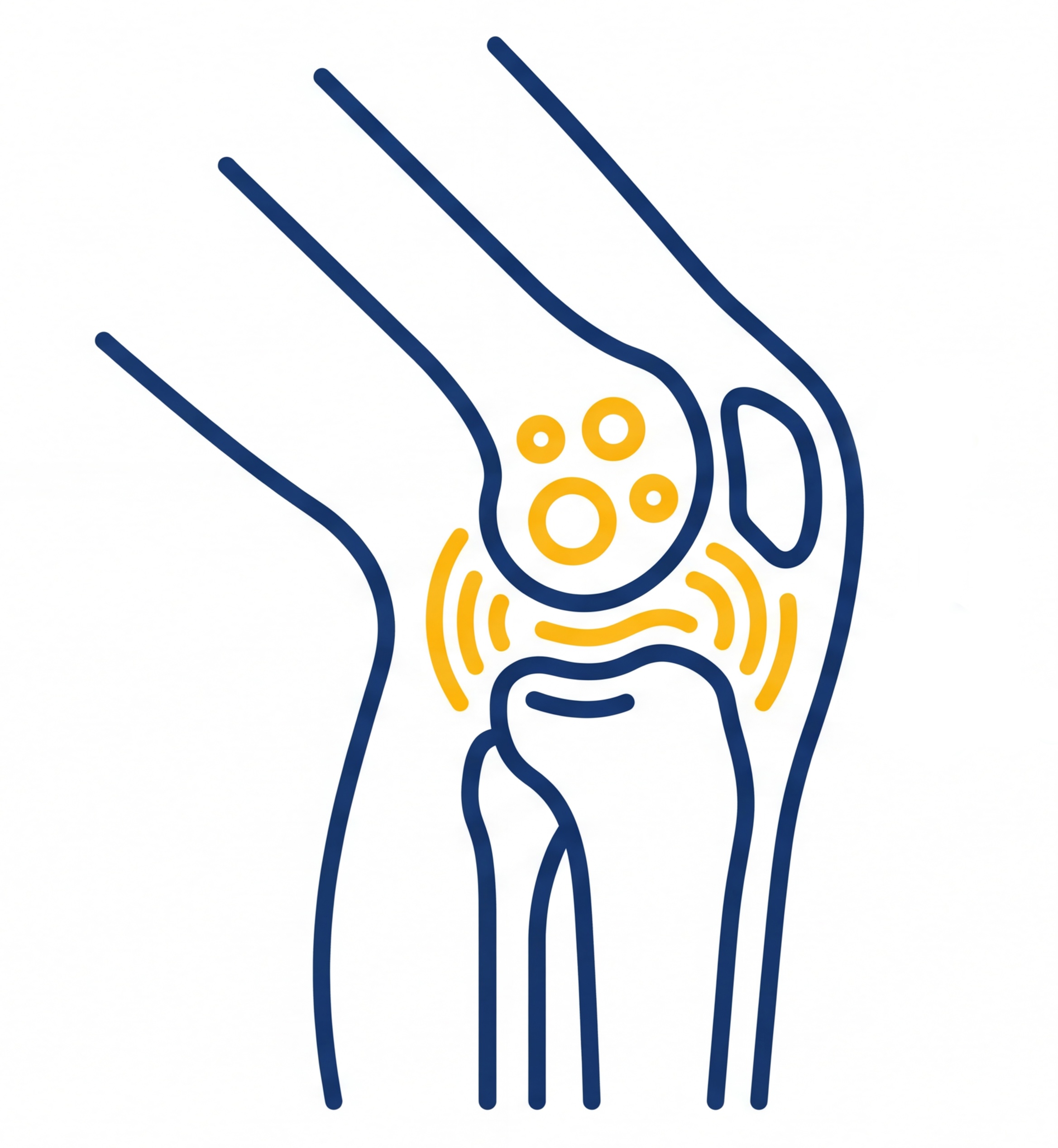 Non-Surgical Joint Pain Treatments | Gel Injection Therapy | Joint ...