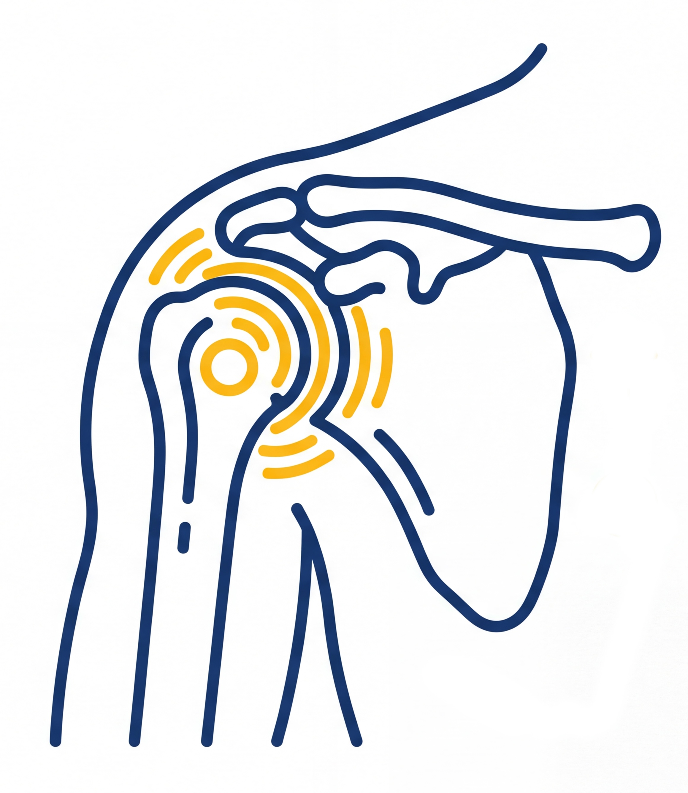 Non-Surgical Joint Pain Treatments | Gel Injection Therapy | Joint ...